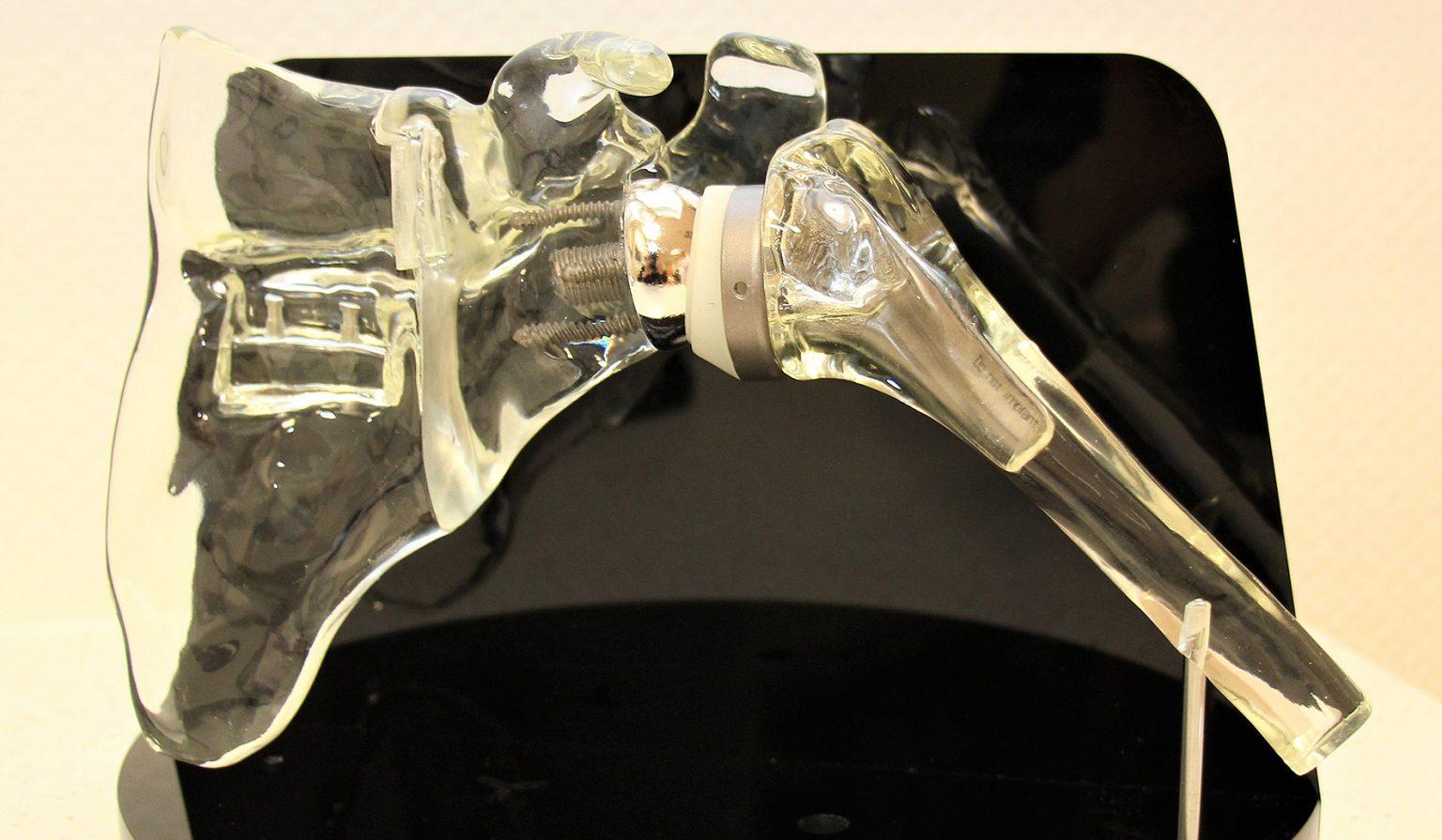 pir_2021-03-18__inverse Schulterprothese_HeliosPirna - Top Gesundheitsforum